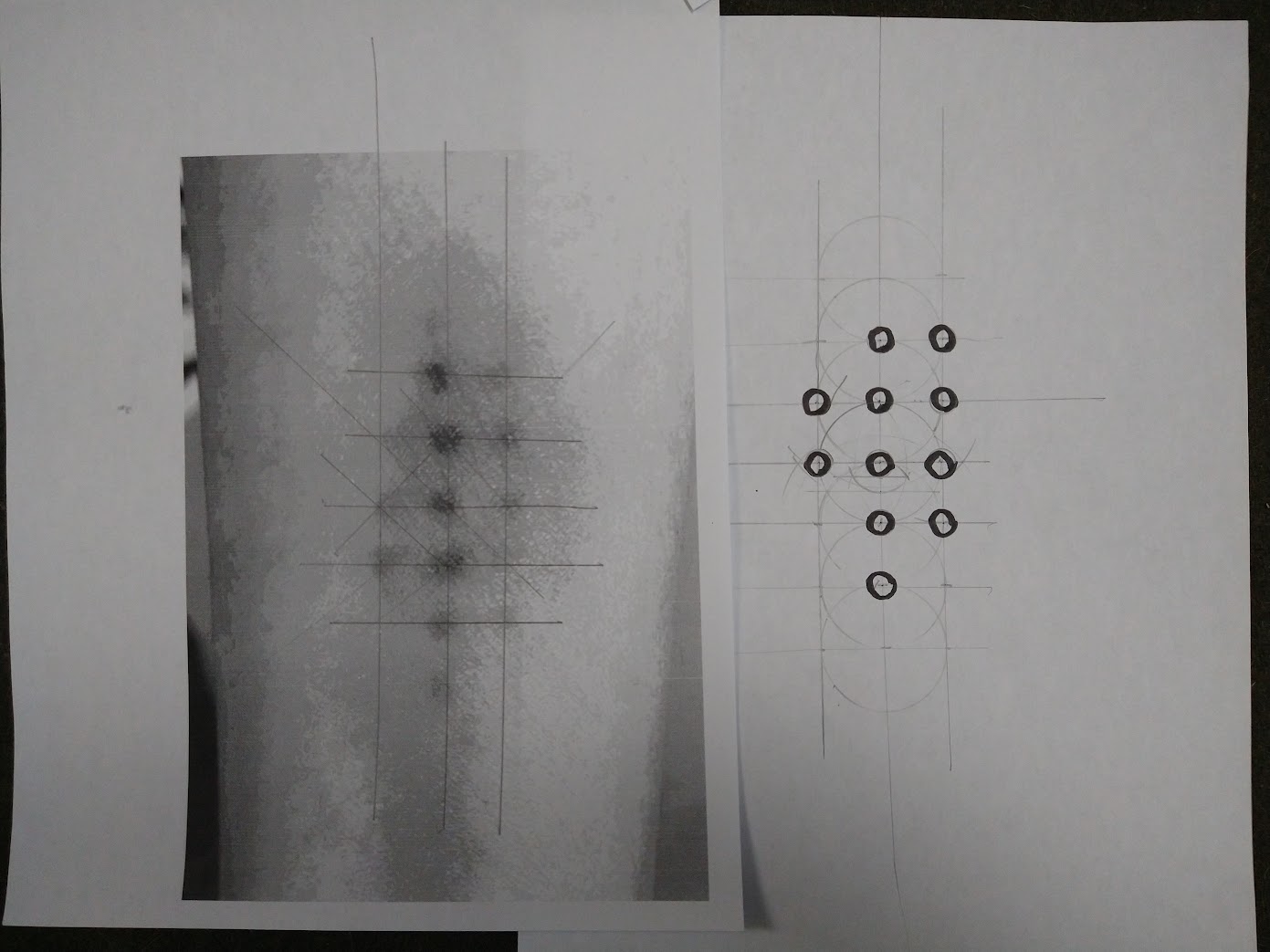 RGMP on Plastic Surgeon - D-SETI Dreamwork